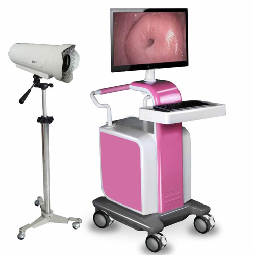 Colposcope optique numérique,Colposcope